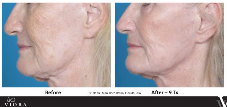 Alphamedix | ST02 - Alphamedix