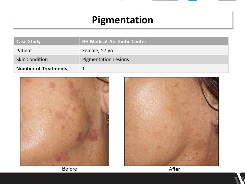 Alphamedix | Trios Product Presentation 02 - Alphamedix