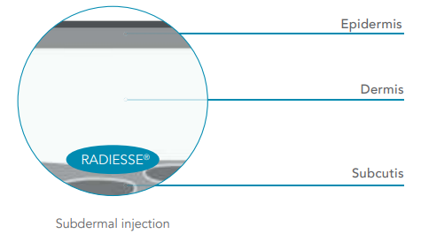 Alphamedix | injection depth - Alphamedix
